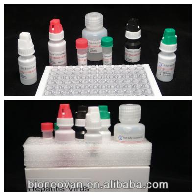 China High Sensitivity HBsAg ELISA Test Kit with 2-3 Hours Assay Time and 18 Months Shelf Life for Hepatitis B Detection for sale