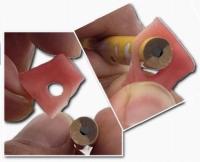 China Gingiva Resin for sale