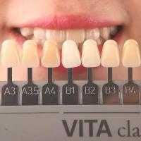 China VITA Classical A1-D4 + Bleached Shades M1-M3 29-Color Dental Shade Guide — Professional Tooth Shade Selector for Porcelain Veneers, Crowns, Bridges, Implants & Composite Restorations for sale