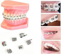 China Lightweight Orthodontic Bracket Teeth Model Mini Metal Brackets Dental for sale
