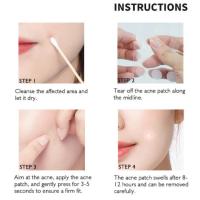 China SJ Invisible Waterproof Adhesive Breathable Hydrocolloid Acne Pimple Patch for sale
