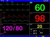 China Rechargeable Battery Portable Patient Monitor Compact and Lightweight for sale