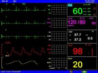 China Rechargeable Battery Portable Patient Monitor Compact and Lightweight for sale