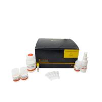China Room Temperature Operation Viral DNA RNA Isolation Kit High Yield for sale