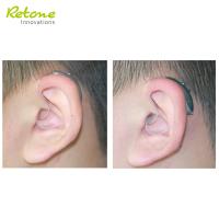 China ISO FDA Approved Over The Counter Hearing Aids For Tinnitus for sale