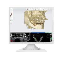 China 17 Inch 4:3 LED Computer Monitor 1280x1024 HDMI VGA VESA 75mm Square Screen for sale